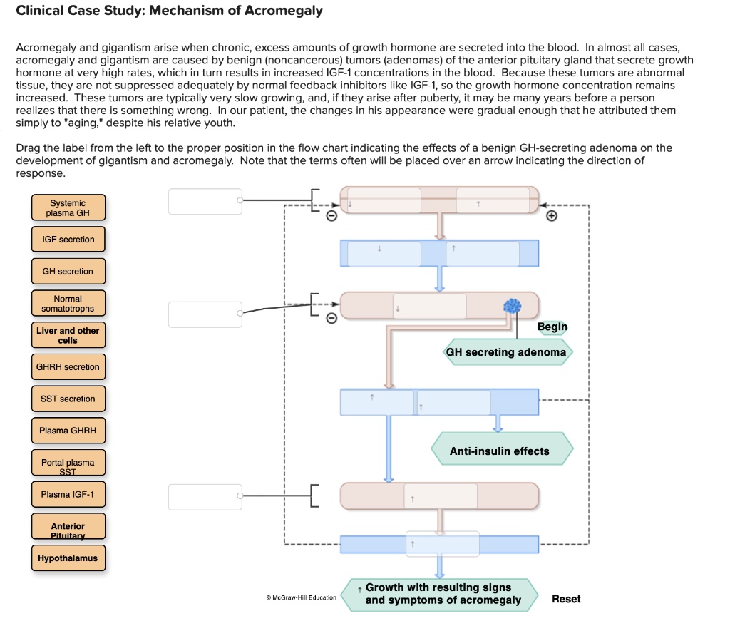 SOLVED: Clinical Case Study: Mechanism of Acromegaly Acromegaly and ...