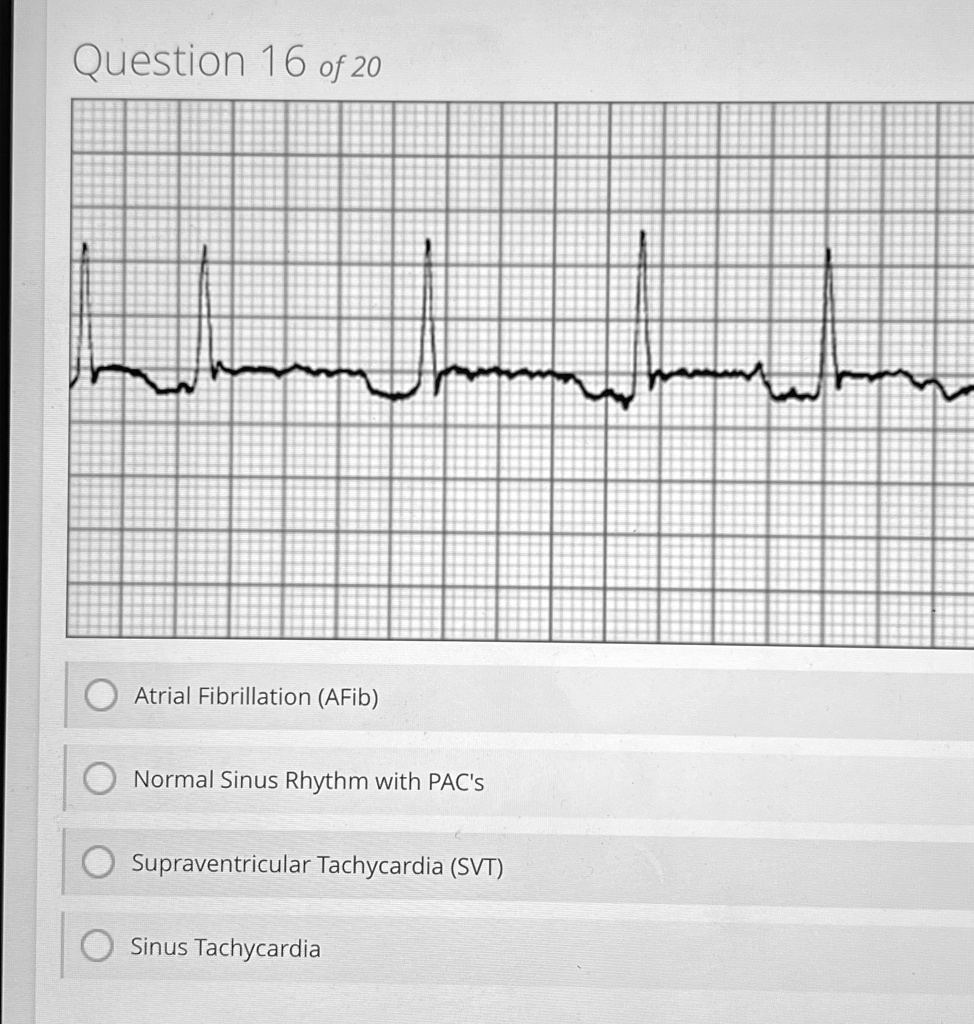 Question 16 of 20 Atrial Fibrillation (AFib) Normal Sinus Rhythm with ...