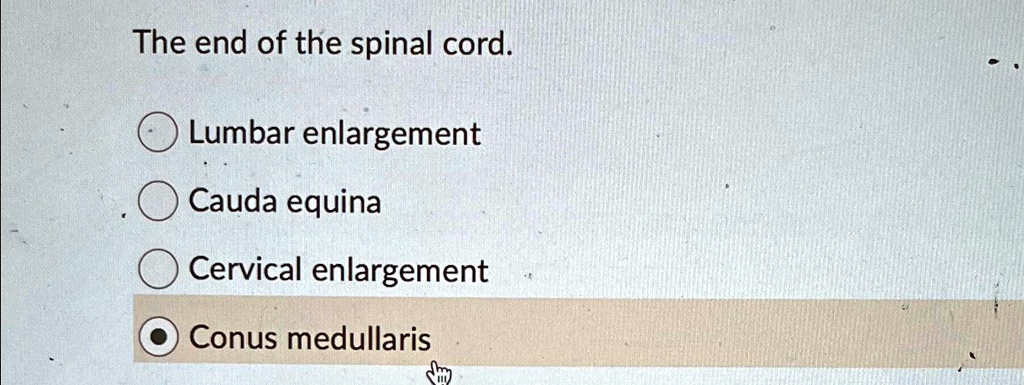 The end of the spinal cord. Lumbar enlargement Cauda equina Cervical ...