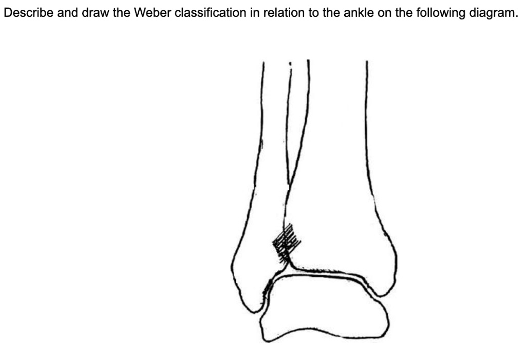 SOLVED: Describe and draw the Weber classification in relation to the ...