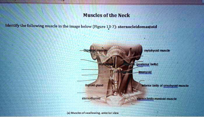 Muscles of the Neck Identify the following muscle in the image below ...