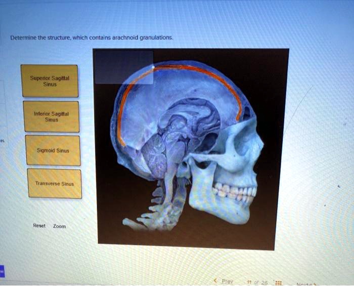SOLVED: Determine the structure which contains arachnoid granulations ...