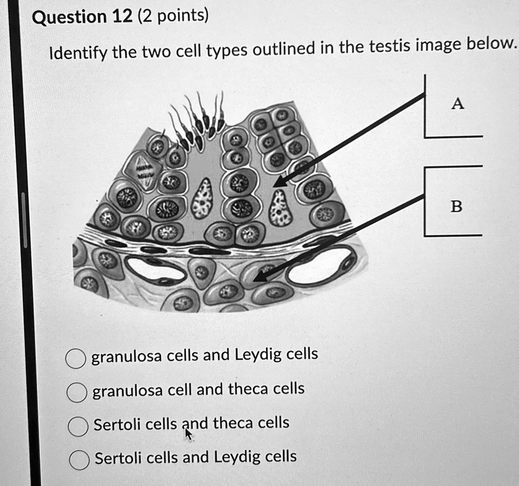 Question 12 (2 points) Identify the two cell types outlined in the ...