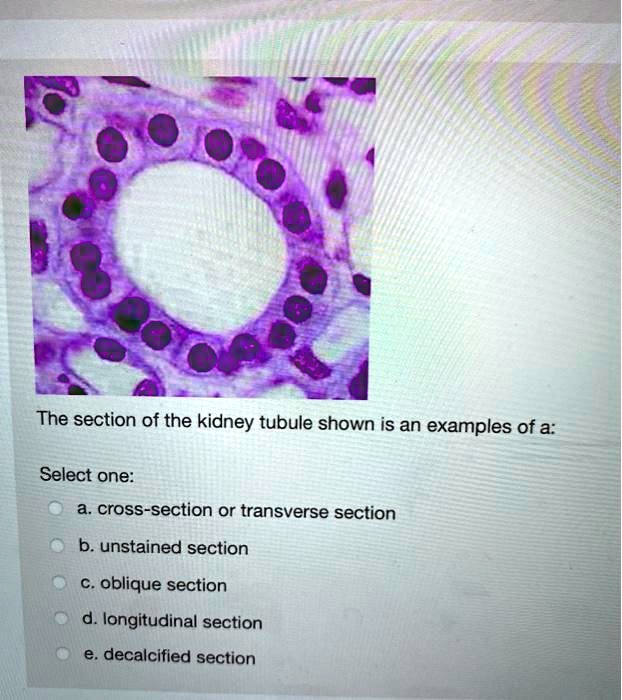 SOLVED: The section of the kidney tubule shown is an example of a: Select one: cross-section or ...