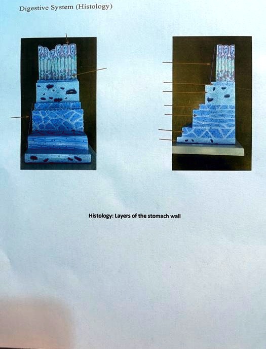 SOLVED: Digestice System: name the structures tagged by the arrows ...
