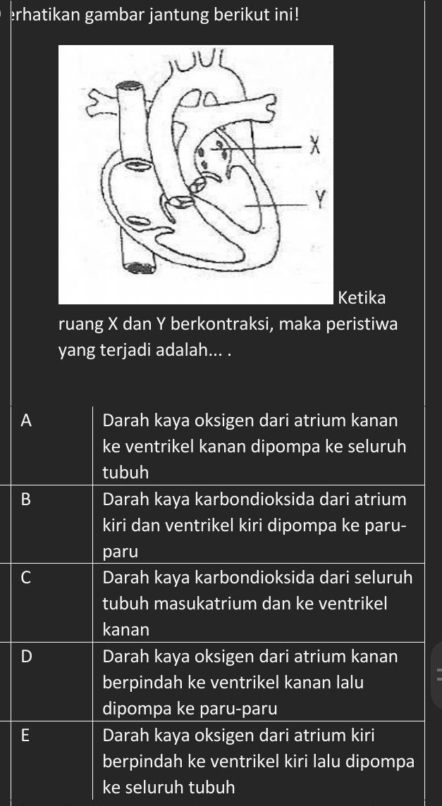 SOLVED: |rhatikan gambar jantung berikut ini! Ketika ruang X dan Y ...