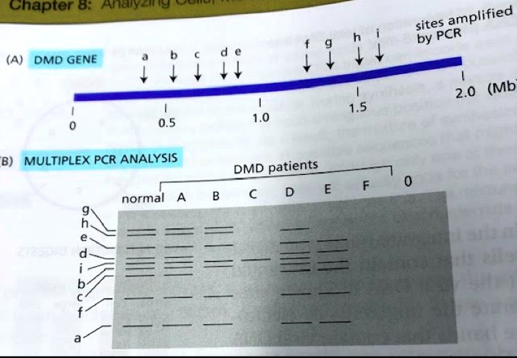 Chapter 8: A (A) DMD GENE a b c d e ??? ???? f g h i ??? ???? sites ...