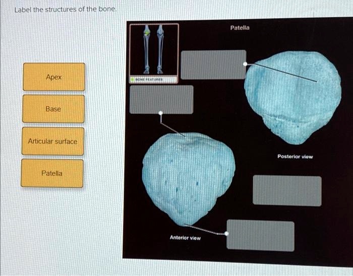 Solved Label The Structures Of The Bone Apex Base Articular Surface