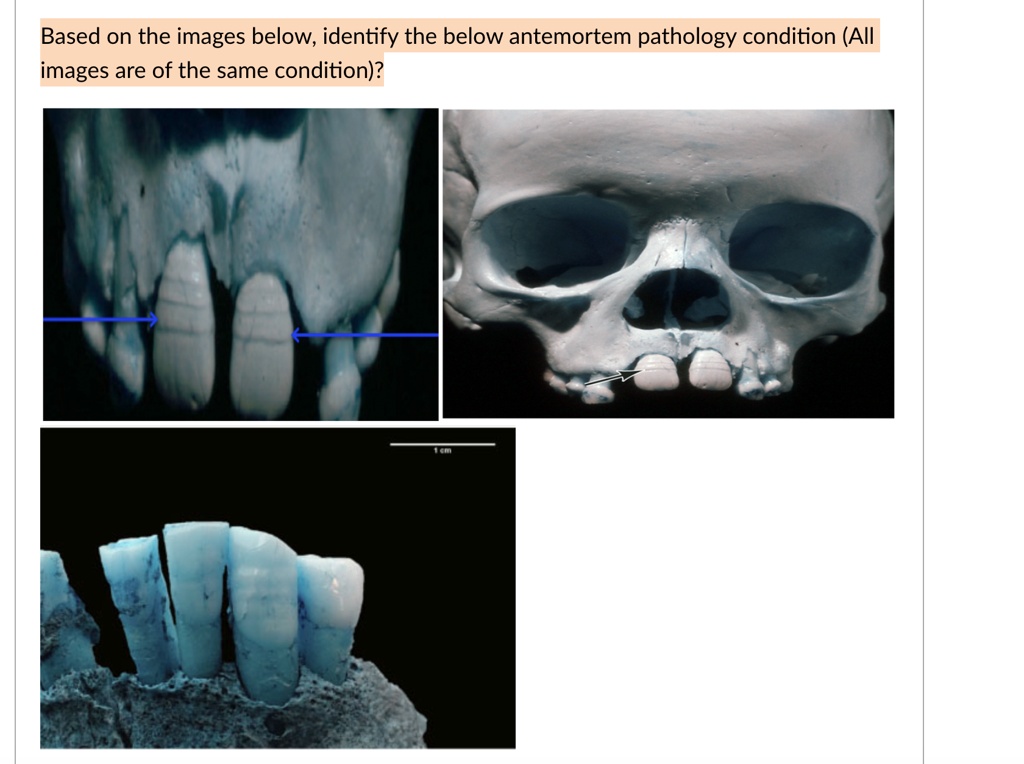 SOLVED: Based on the images below, identify the below antemortem ...