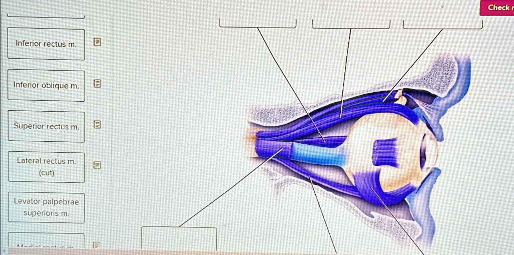 Inferior rectus m. Inferior oblique m. Superior rectus m. Lateral ...
