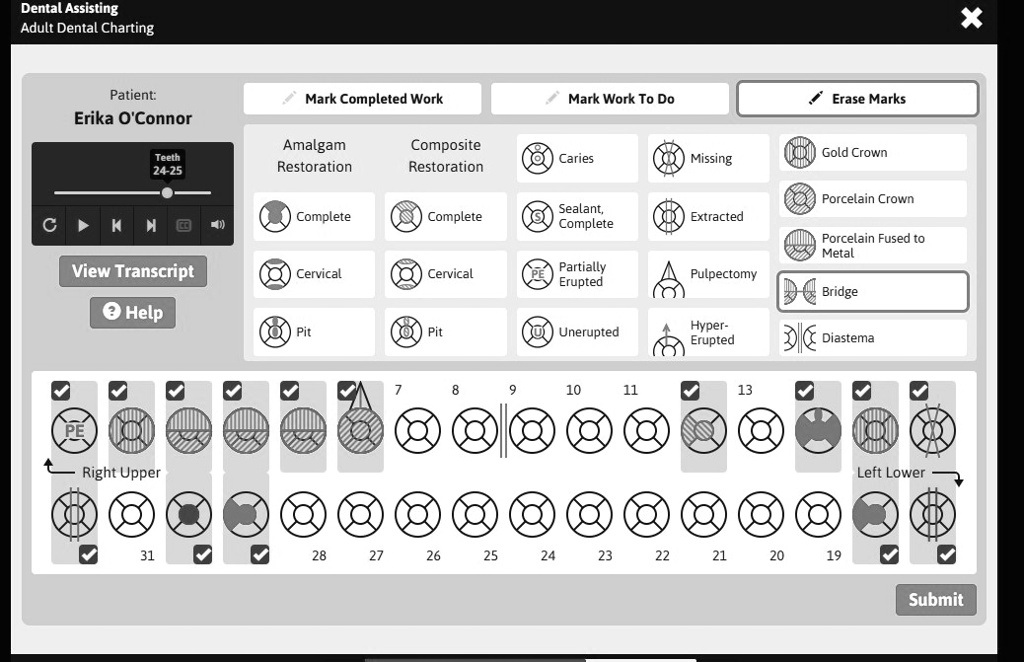 Dental Assisting Adult Dental Charting Patient: Erika O'Connor Teeth 24 ...