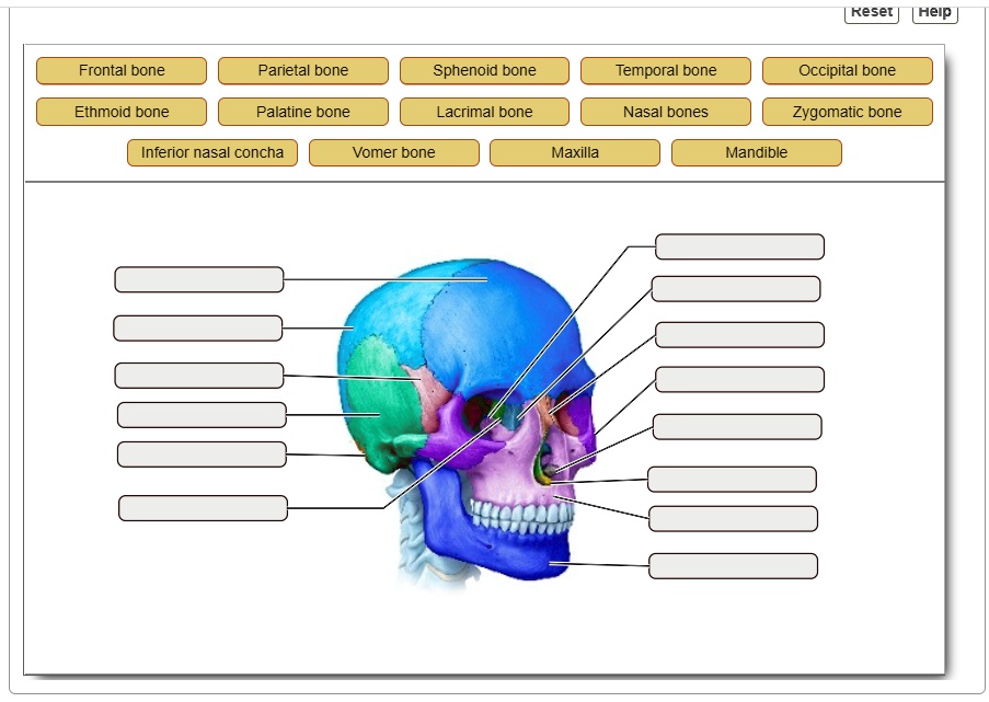 Frontal bone Parietal bone Sphenoid bone Temporal bone Occipital bone ...