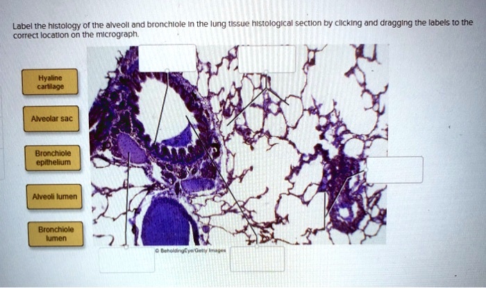 Label the histology of the alveolus and bronchiole in the lung tissue ...