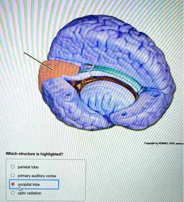 SOLVED: Which structure is highlighted? Parietal lobe Primary auditory ...