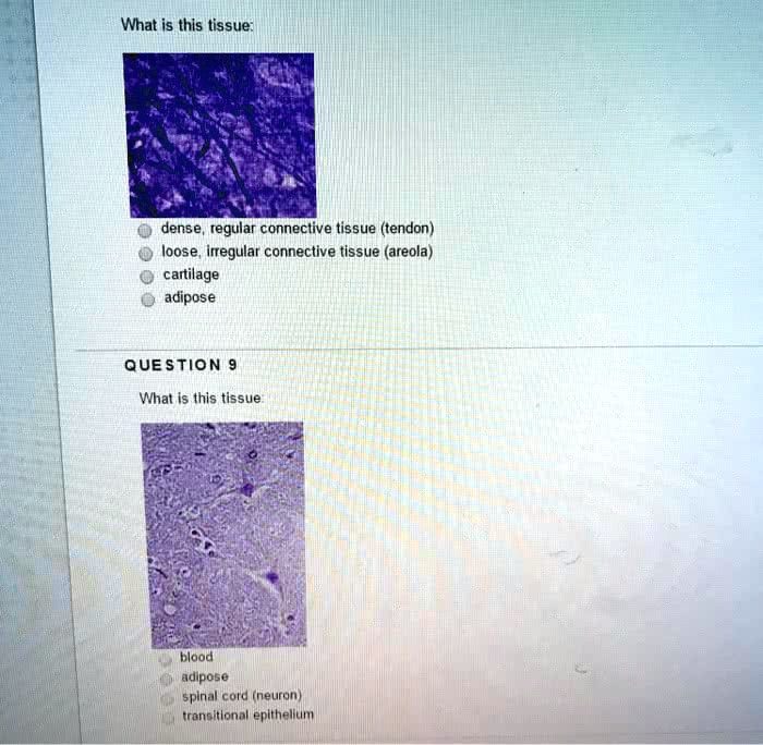 What is this tissue: dense, regular connective tissue (tendon) loose ...