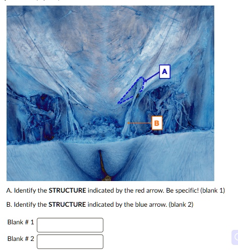 SOLVED: A A. Identify the STRUCTURE indicated by the red arrow. Be specific! (blank 1) B ...
