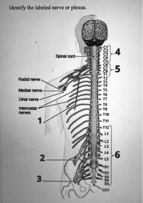 Identify the labeled nerve or plexus_Spinal cord-4 1 … - SolvedLib