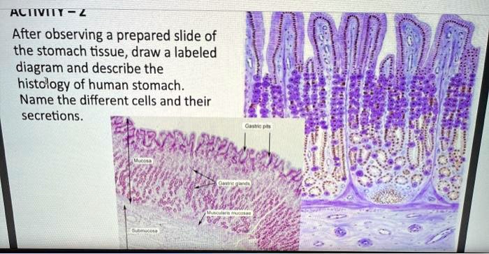actvitw after observing a prepared slide of the stomach tissue draw a ...