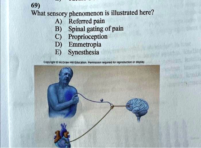 69) What sensory phenomenon is illustrated here? A) Referred pain B ...