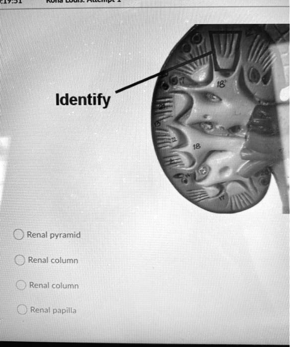 SOLVED: Identify Renal pyramid Renal column Renal column @Renal papilla