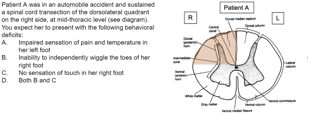 SOLVED: Patient A was in an automobile accident and sustained a spinal ...