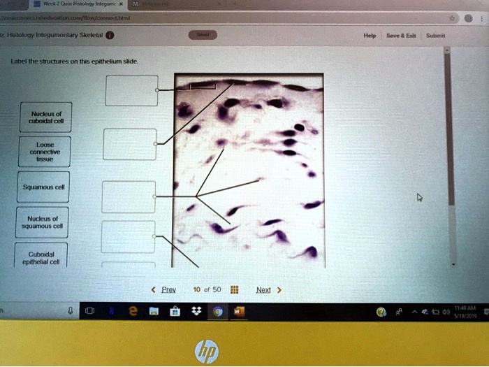 SOLVED: Histology Integumentary Skeletal Solve Submit Label the structure Nucleus of cuboidal ...