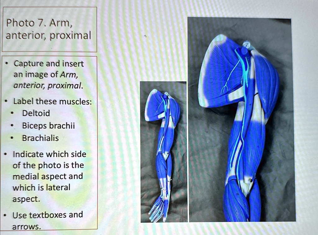 Photo 7 arm anterior proximal capture and insert an image of...