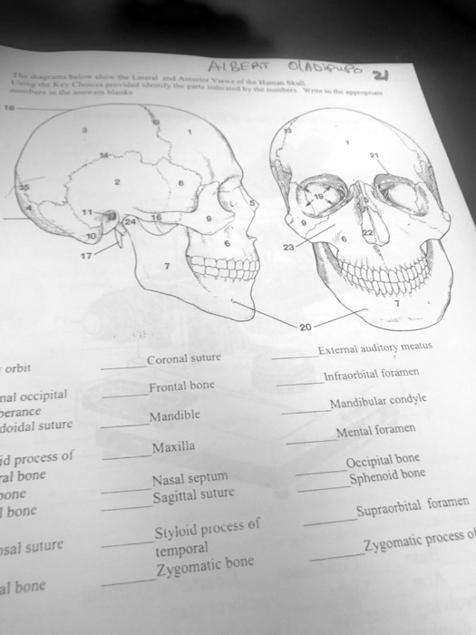 ALBERT OLADIPUPO 21 The diagrams below shew the Lateral and Anterior Views of the Human Skull ...