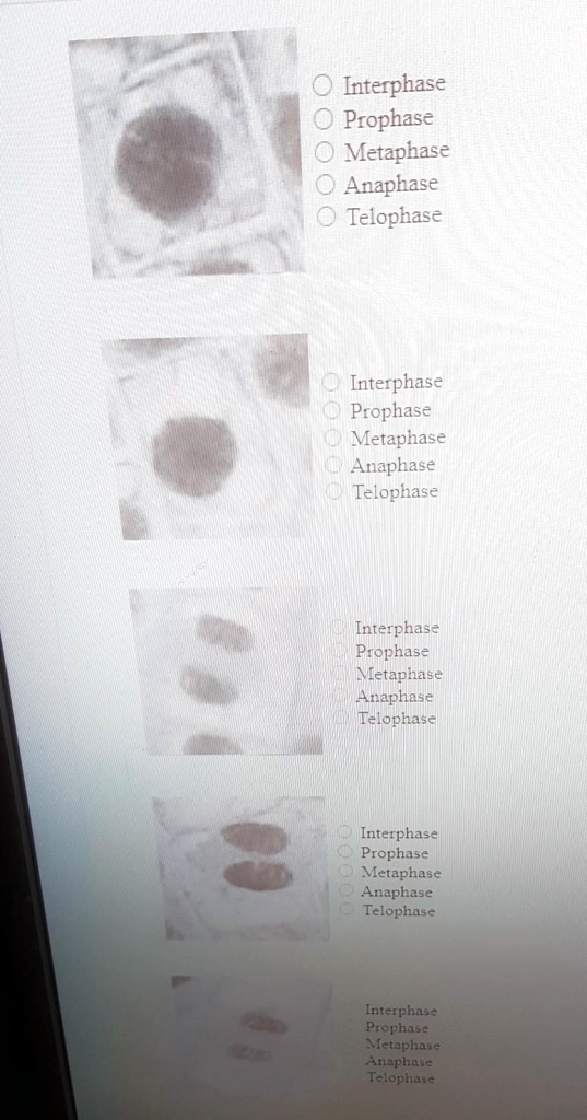 [GET ANSWER] interphase prophase metaphase anaphase telophase ...