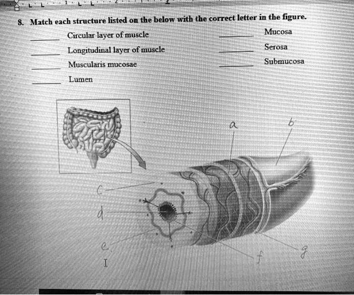 8. Match each structure listed on the below with the correct letter in ...
