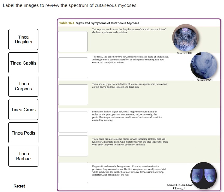 Label the images to review the spectrum of cutaneous mycoses. Table 16. ...