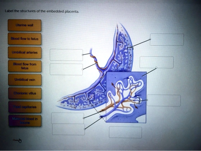 SOLVED: Label the structures of the embedded placenta: - Uterine wall ...