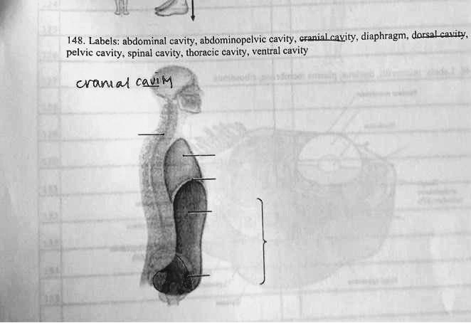 148. Labels: abdominal cavity, abdominopelvic cavity, cranial cavity ...