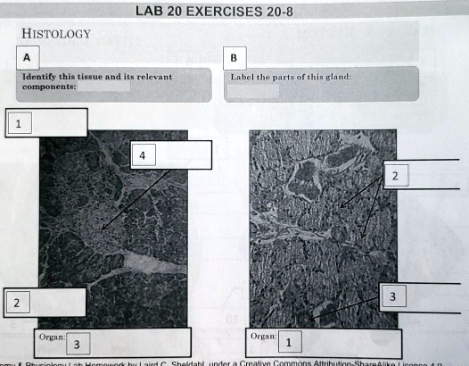 SOLVED: LAB 20 EXERCISES 20-8 HISTOLOGY B Identify this tissue and its ...