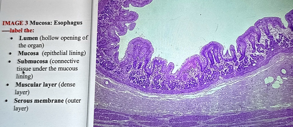 IMAGE 3 Mucosa: Esophagus —–label the: • Lumen (hollow opening of the ...