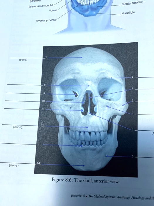 SOLVED: Ethmoid Inferior nasal concha Vomer Mental foramen Mandible ...