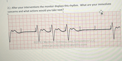 2.) After your interventions the monitor displays this rhythm. What are ...