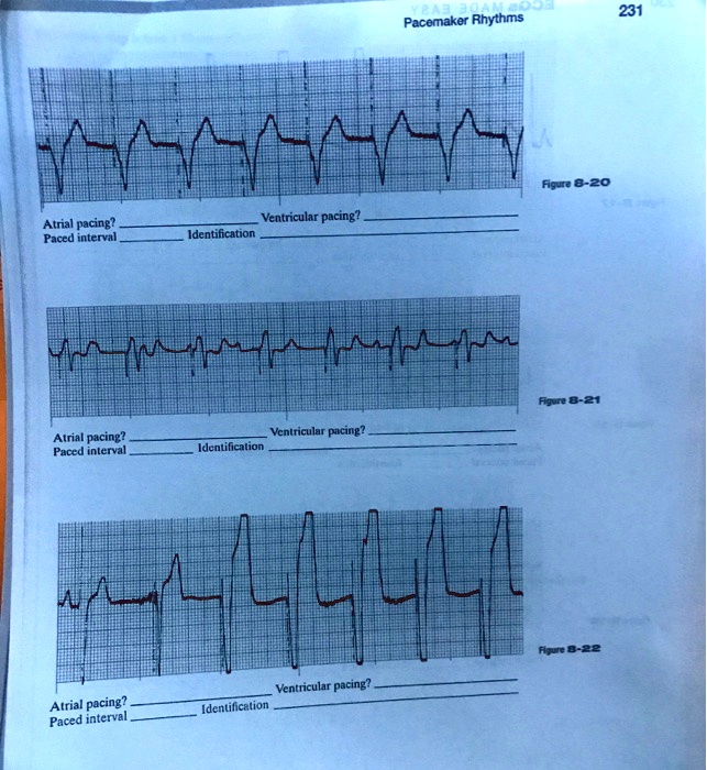 SOLVED: Pacemaker Rhythms Atrial pacing - Paced interval Ventricular ...