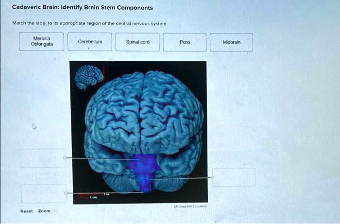 SOLVED: Cadaveric Brain: Identify Brainstem Components Match the label ...