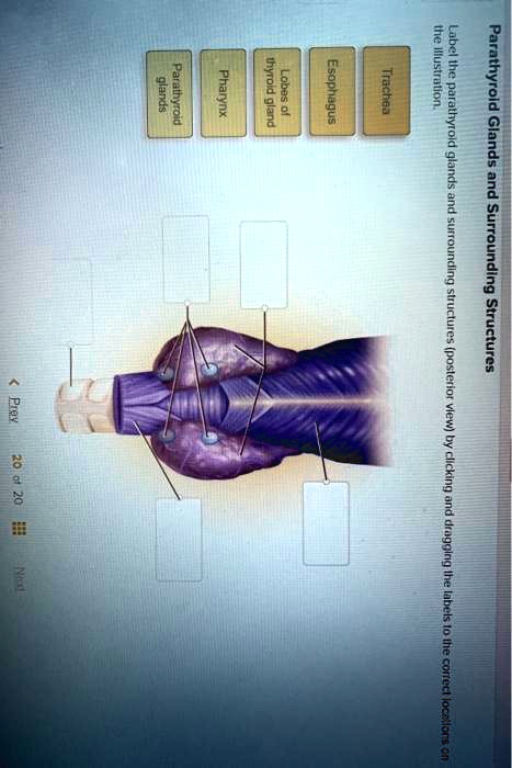 SOLVED: Glands: Parathyroid, Pharynx, Thyroid Gland, Lobes of Esophagus ... SOLVED: Glands: Parathyroid, Pharynx, Thyroid Gland, Lobes of Esophagus ...