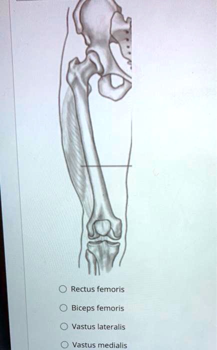 SOLVED: What muscle is being shown Rectus femoris OBiceps femoris ...