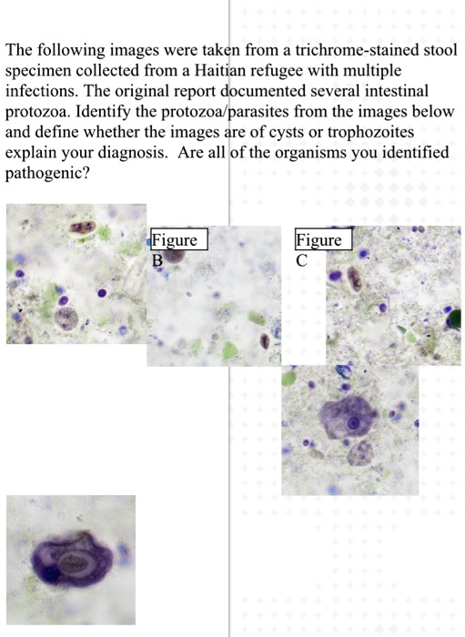 SOLVED: The following images were taken from trichrome-stained stool ...