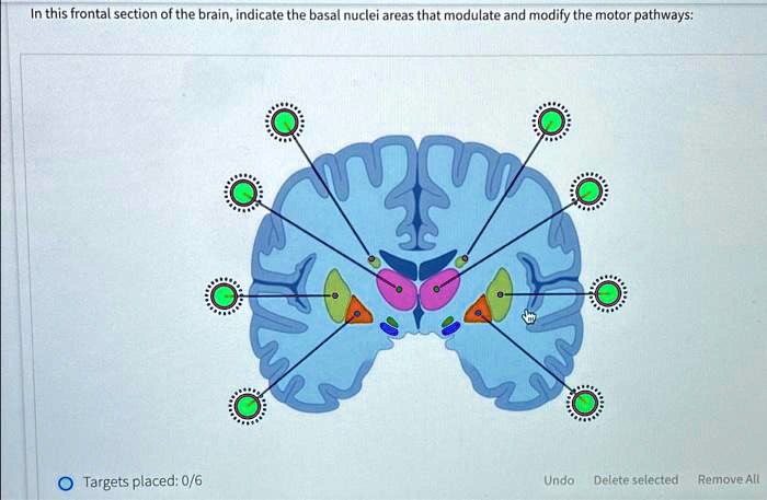 In this frontal section of the brain, indicate the basal nuclei areas ...