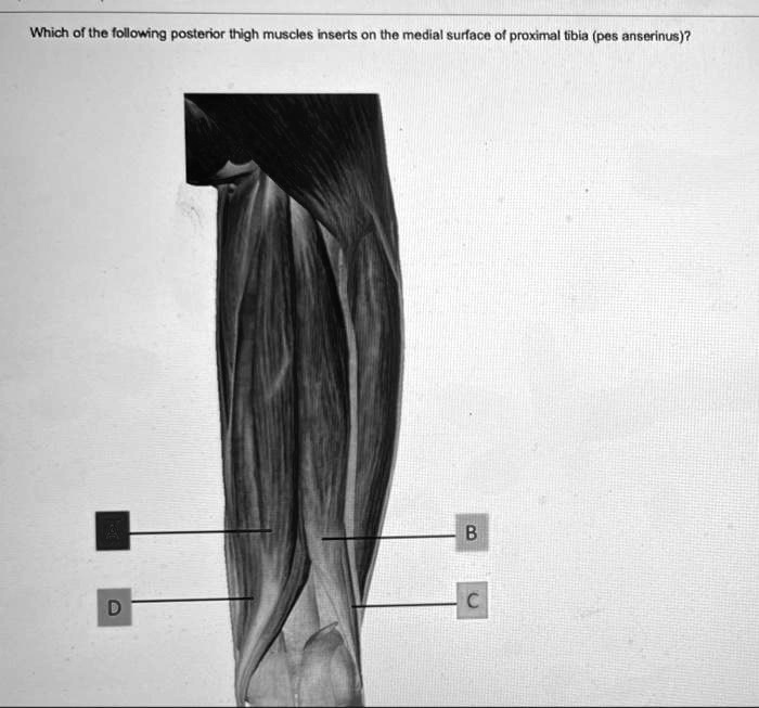 Which of the following posterior thigh muscles inserts on...