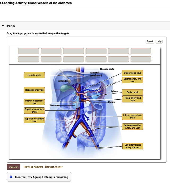 SOLVED: t-Labeling Activity: Blood Vessels of the Abdomen Part A Drag ...