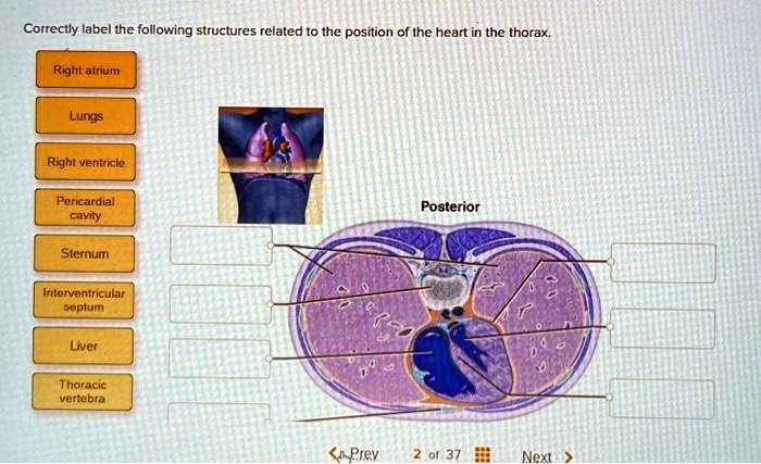 Texts: Correctly label the following structures related to the position of the heart in the ...