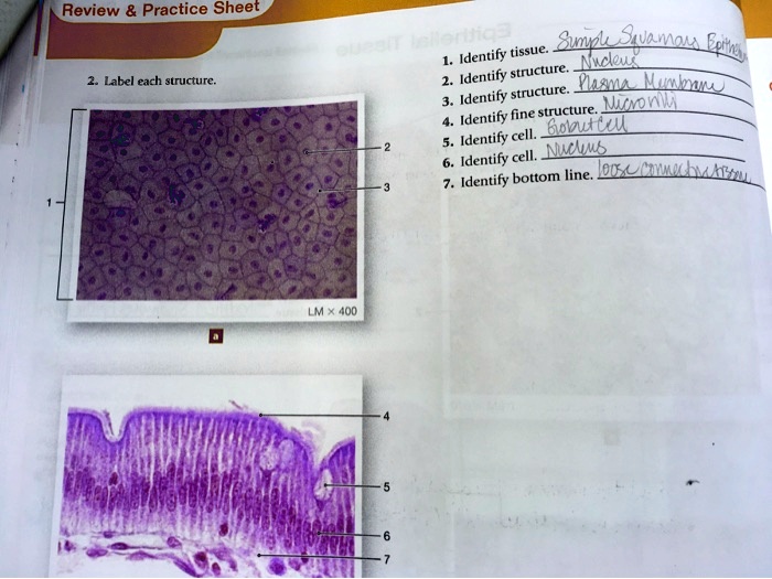 SOLVED: Tissue Structure Review Practice Sheet 1. Identify epithelial tissue. 2. Identify ...