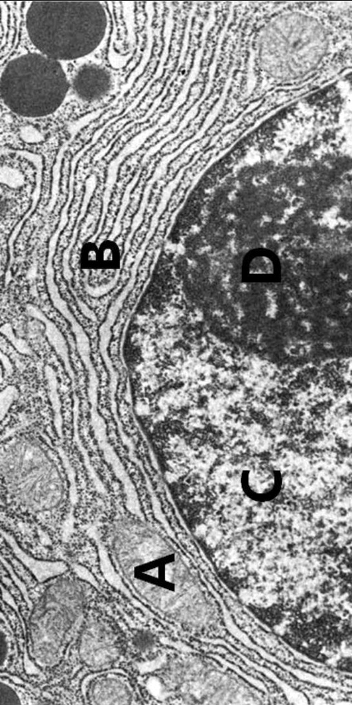 SOLVED: '1. On the following Transmission Electron Micrograph of a ...
