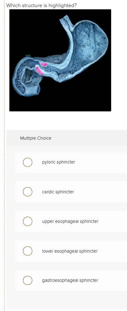 49 which structure is highlighted multiple choice pyloric sphincter ...