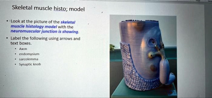 Skeletal muscle histo; model • Look at the picture of the skeletal ...